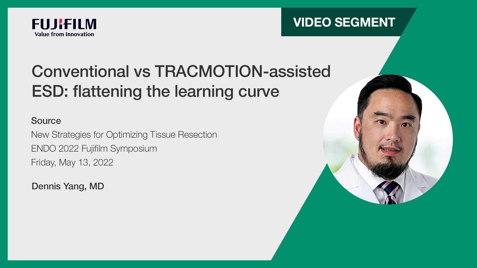Conventional vs TRACMOTION-assisted ESD: flattening the learning curve ...