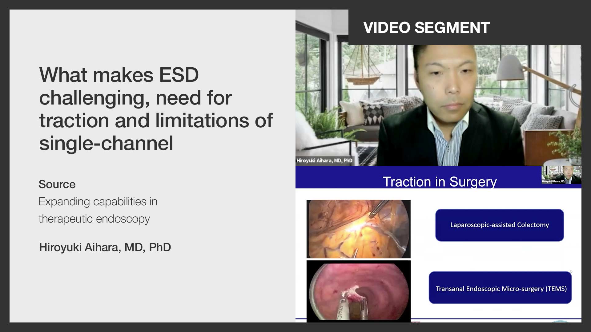 What makes ESD challenging, and need for traction and limitations of single-channel - Clinical ...